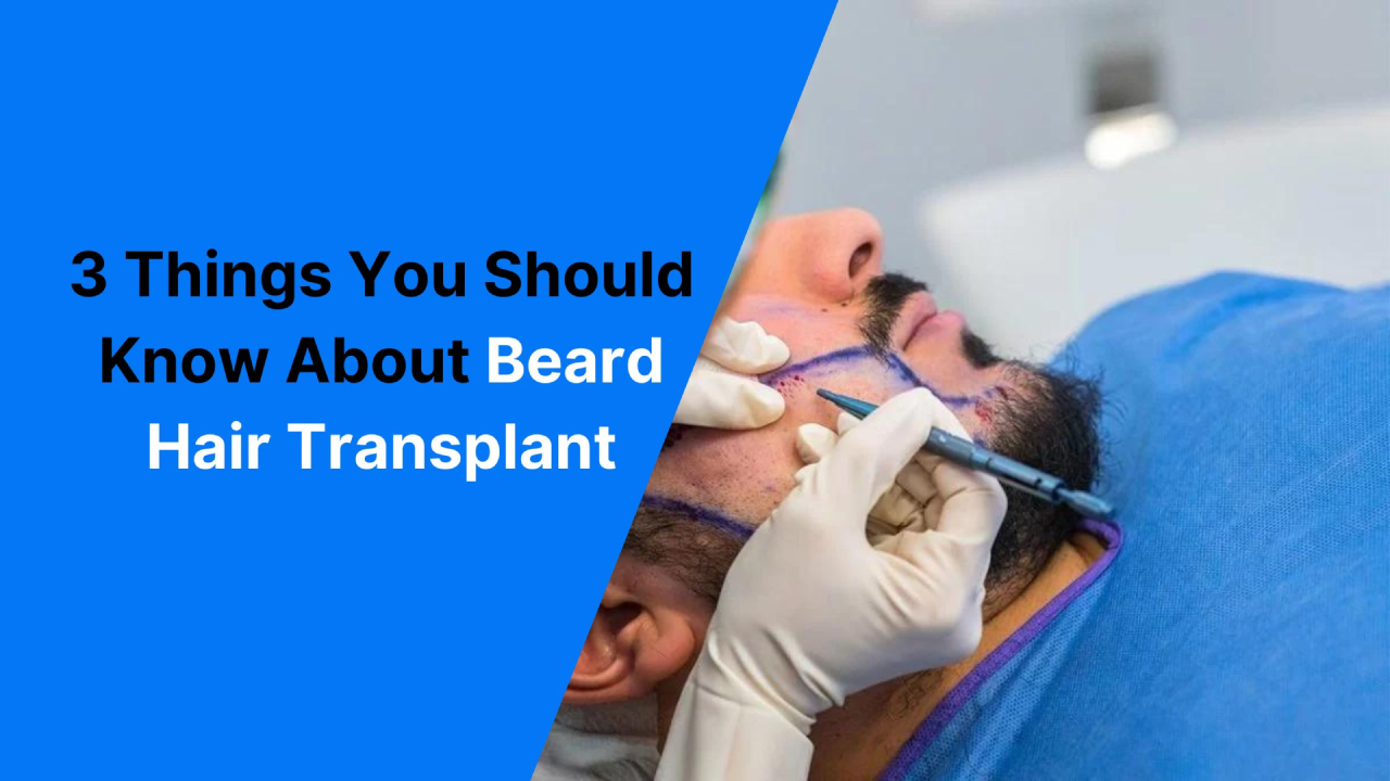 3 Things You Should Know About Beard Hair Transplant